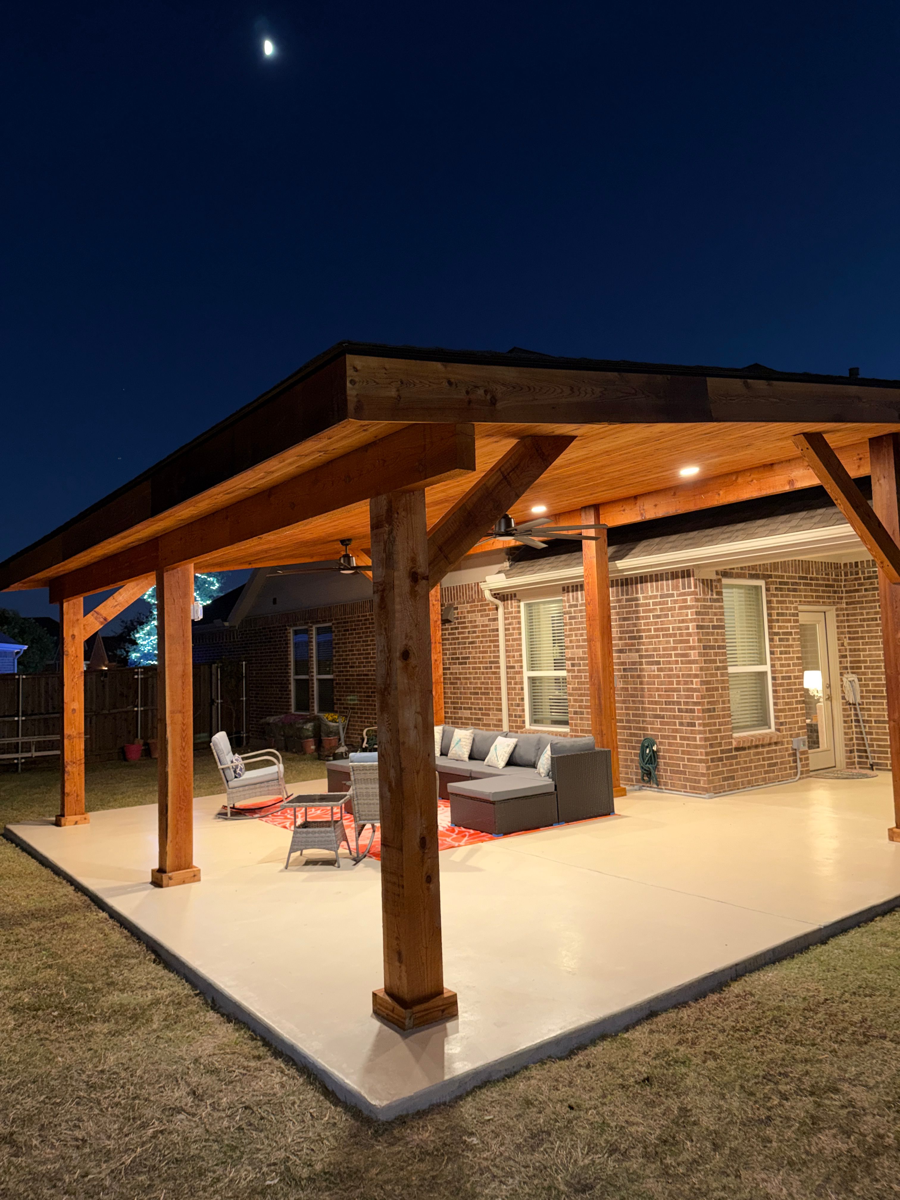 Structure1 Construction | Patio Covers & Concrete in Dallas-Fort Worth